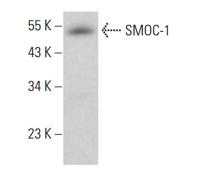 SMOC-1 Antibody (A-10) | SCBT - Santa Cruz Biotechnology