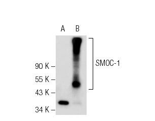 SMOC-1抗体 (C-2) | SCBT - Santa Cruz Biotechnology