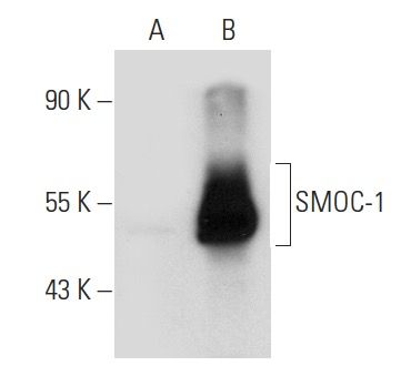 SMOC-1抗体 (F-3) | SCBT - Santa Cruz Biotechnology