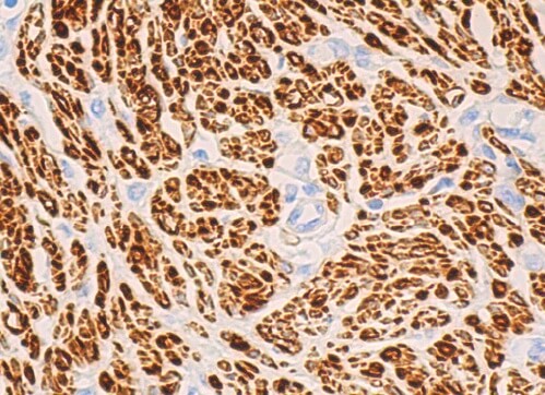 Anti-Smooth Muscle Actin Antibody (B4) | SCBT - Santa Cruz Biotechnology