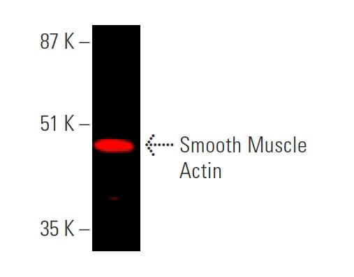 Anti-Smooth Muscle Actin Antibody (B4) | SCBT - Santa Cruz Biotechnology