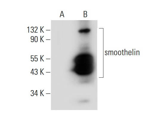 Anti-smoothelin Antibody (B-1) | SCBT - Santa Cruz Biotechnology