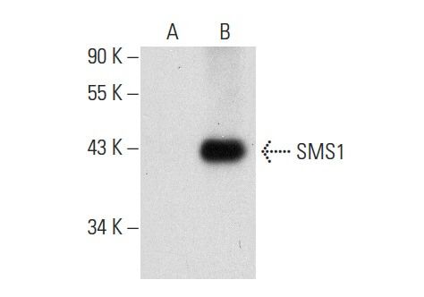 SMS1 Antibody (F-10) | SCBT - Santa Cruz Biotechnology