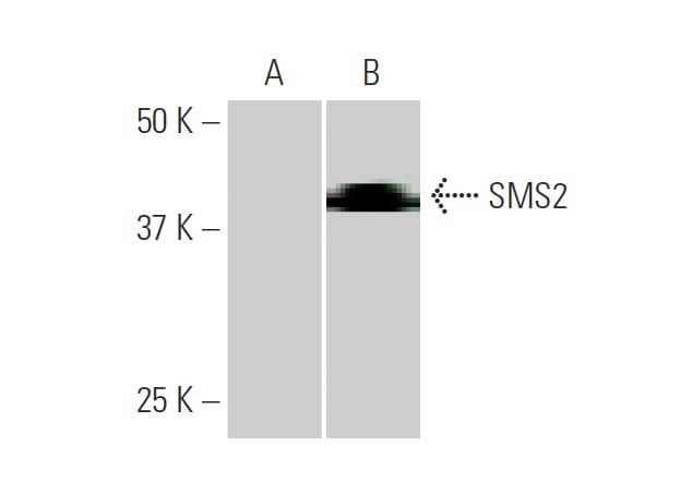 Anti-SMS2 Antibody (7D10) | SCBT - Santa Cruz Biotechnology