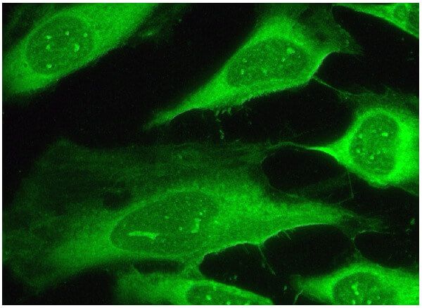 SMVT Antibody (D-11) | SCBT - Santa Cruz Biotechnology