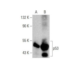 SN 38: sc-203697. Western blot analysis of p53 expression in...