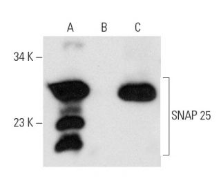 SNAP 25 Antibody (SP12) - Western Blotting - Image 19344