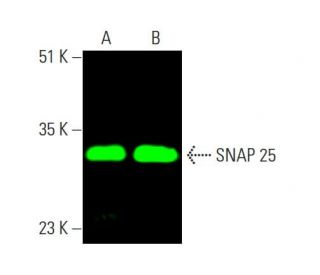 SNAP 25 Antibody (SP12) - Western Blotting - Image 386224