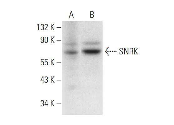 Anti-SNRK Antibody (A-3) | SCBT - Santa Cruz Biotechnology