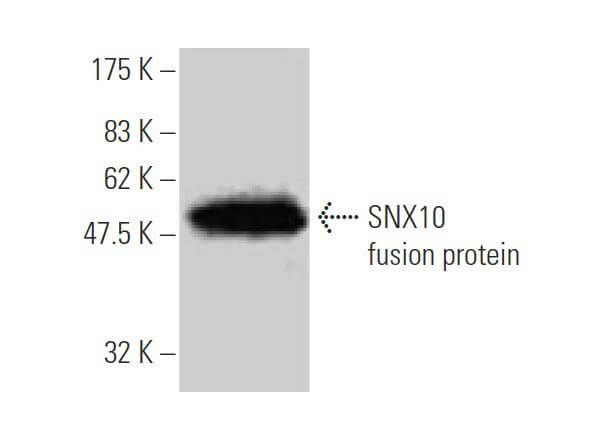 SNX10抗体 (1G5) | SCBT - Santa Cruz Biotechnology