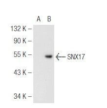 SNX17 Antibody (D-10) | SCBT - Santa Cruz Biotechnology