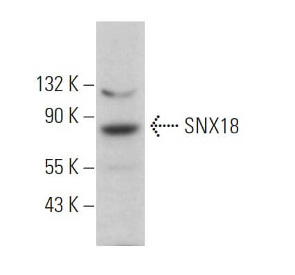 SNX18 Antibody (F-10) | SCBT - Santa Cruz Biotechnology