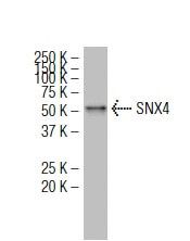 SNX4 Antibody (Y-36) | SCBT - Santa Cruz Biotechnology