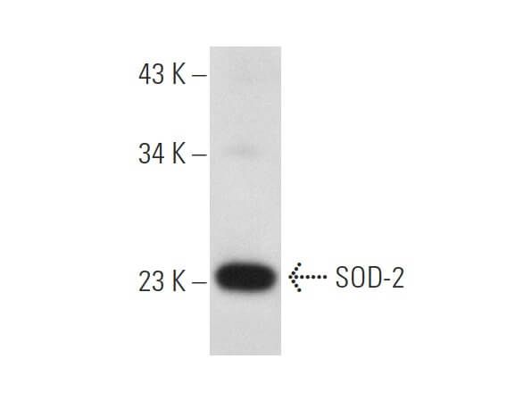 Superoxide Dismutase 2/SOD2 Antibody (24) | SCBT - Santa Cruz Biotechnology