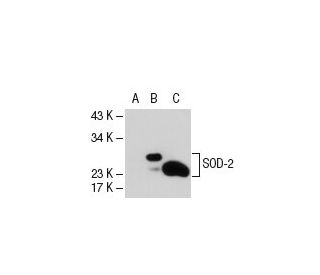 SOD-2 Antibody (A-2) - Western Blotting - Image 55064