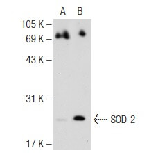 Superoxide Dismutase 2/SOD2 Antibody (A-2) | SCBT - Santa Cruz ...