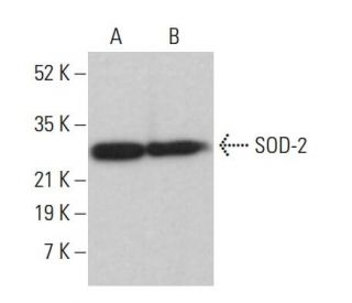 Superoxide Dismutase 2/SOD2 Antibody (A-2) | SCBT - Santa Cruz ...