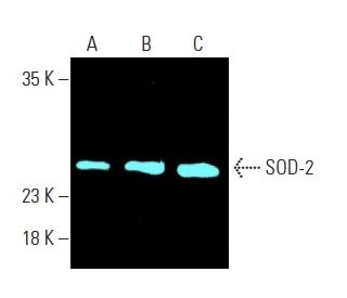 Anti-Superoxide Dismutase 2/SOD2 Antibody (A-2) | SCBT - Santa Cruz ...