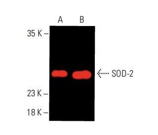 Superoxide Dismutase 2/SOD2 Antibody (A-2) | SCBT - Santa Cruz ...
