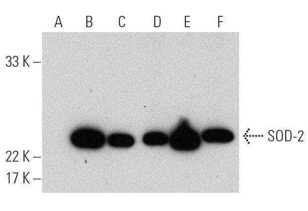 SOD-2 Anticuerpo (N-20) | SCBT - Santa Cruz Biotechnology