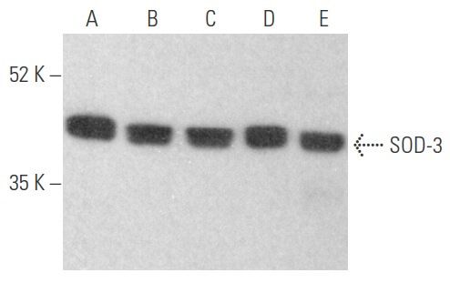Superoxide Dismutase 3/SOD3 Antibody (G-11) | SCBT - Santa Cruz ...