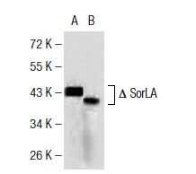 SorLA Antibody (7D7B11) | SCBT - Santa Cruz Biotechnology
