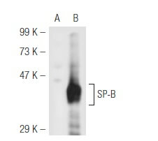 Anti-SP-B Antibody (F-2) | SCBT - Santa Cruz Biotechnology