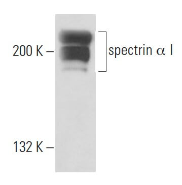 Anti-spectrin α I Antibody (IID2) | SCBT - Santa Cruz Biotechnology