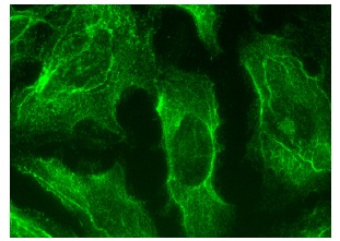 spectrin α II Antibody (B-2) | SCBT - Santa Cruz Biotechnology