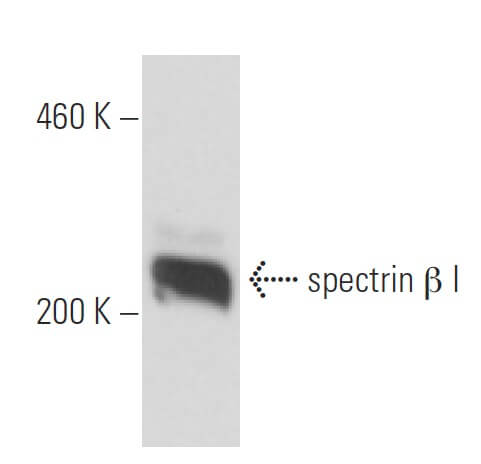 spectrin β I Antibody (4C3) | SCBT - Santa Cruz Biotechnology