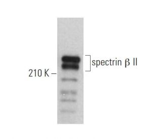 Anti-spectrin β II Antibody (F-11) | SCBT - Santa Cruz Biotechnology