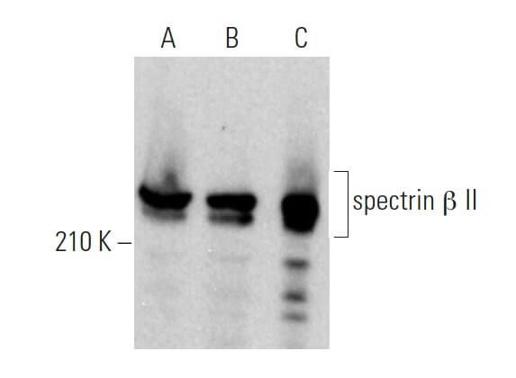spectrin β II Antibody (F-11) | SCBT - Santa Cruz Biotechnology