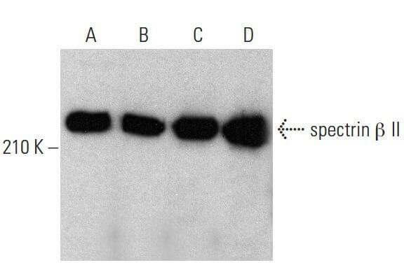 spectrin β II Antibody (F-7) | SCBT - Santa Cruz Biotechnology