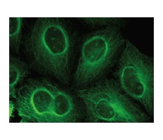 spectrin β II Antibody (H-5) | SCBT - Santa Cruz Biotechnology