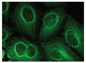spectrin β II Antibody (H-5) | SCBT - Santa Cruz Biotechnology