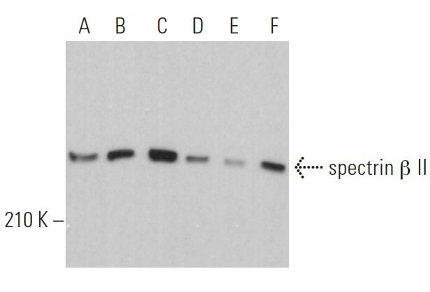 spectrin β II Antibody (H-5) | SCBT - Santa Cruz Biotechnology