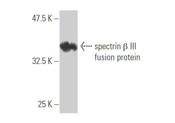 Anti-spectrin β III Antibody (4D9) | SCBT - Santa Cruz Biotechnology