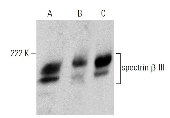 spectrin β III Antibody (A-8) | SCBT - Santa Cruz Biotechnology