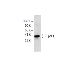 Anti-SphK1 Antibody (G-11) | SCBT - Santa Cruz Biotechnology