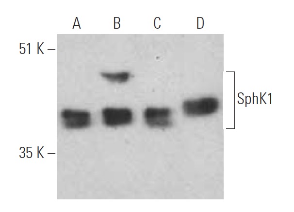 Anti-SphK1 Antibody (G-11) | SCBT - Santa Cruz Biotechnology