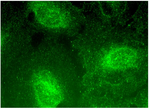 Anti-SPOP Antibody (B-8) | SCBT - Santa Cruz Biotechnology