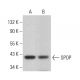 SPOP抗体 (B-8) | SCBT - Santa Cruz Biotechnology
