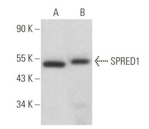 SPRED1 Antibody (E-5) | SCBT - Santa Cruz Biotechnology
