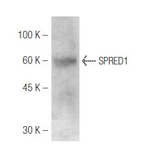 SPRED1 Antibody (M23-P2G3) | SCBT - Santa Cruz Biotechnology