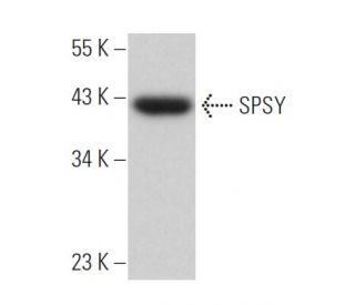 SPSY Antibody (A-4) | SCBT - Santa Cruz Biotechnology
