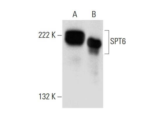 SPT6 Antibody (E-4) | SCBT - Santa Cruz Biotechnology