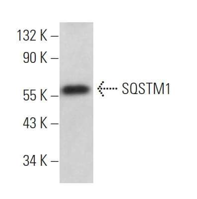 Anti-SQSTM1/p62 Antibody (D-3) | SCBT - Santa Cruz Biotechnology