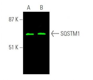 SQSTM1 Antibody (D-3) - Western Blotting - Image 369634