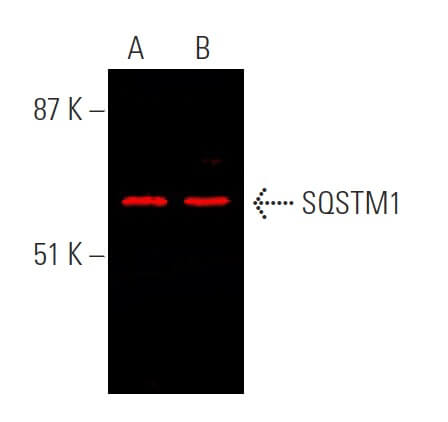 Anti-SQSTM1/p62 Antibody (D-3) | SCBT - Santa Cruz Biotechnology