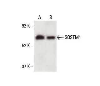 SQSTM1 Antibody (D-3) - Western Blotting - Image 398282
